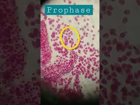 Prophase- under Microscope - Mitotic cell cycle. Cell biology practical 💥