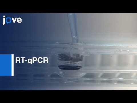 RT-qPCR of Single cell Genes for Lymphoid Heterogeneity Analysis | Protocol Preview