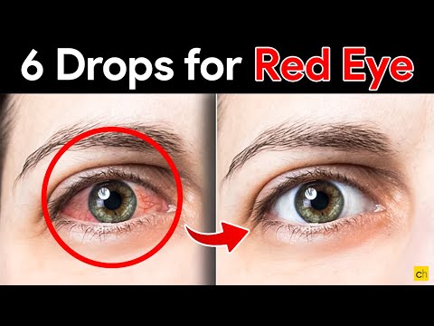 Fast and Effective: 6 Eye Drops to Cure Red Eyes - Credihealth