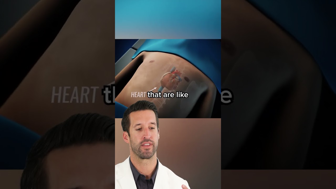 ER Doctor REACTS to Pectus Excavatum