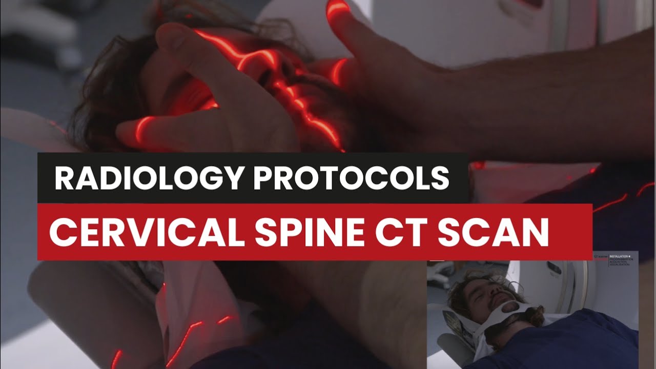 Protocols for CT of the Cervical Spine: A Guide for Radiology Techs