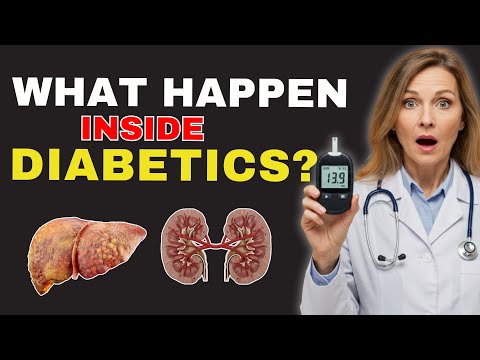 What Doctors Don't Tell You About Type 2 Diabetes | Senior Health Tips