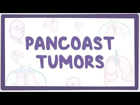 Pancoast tumors - causes, symptoms, diagnosis, treatment, pathology