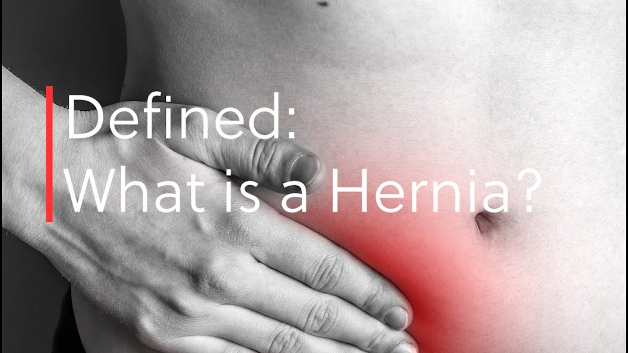 Abdominal Wall + Umbilical Hernia in Billings, MT with Dr. Dr. Clewley