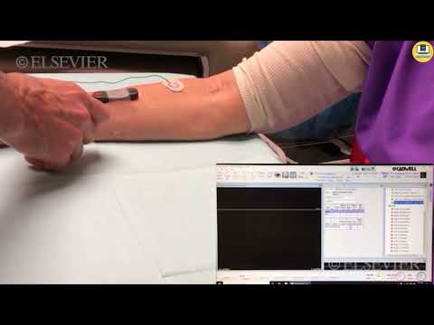 (P002) Lateral Antebrachial Cutaneous Nerve Conduction Study