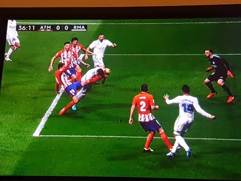 Sergio Ramos Gets Hard Injury - Nose broken
