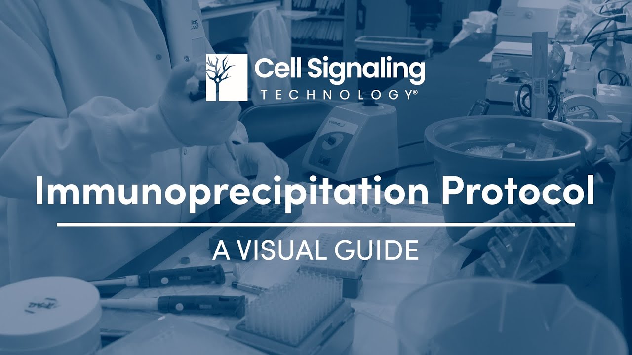 Immunoprecipitation Protocol: A Visual Guide | Cell Signaling Technology