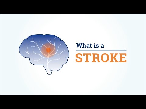 What is a stroke? What are the different types of strokes?