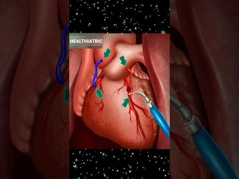 biology | Heart stud surgery | practicalskills