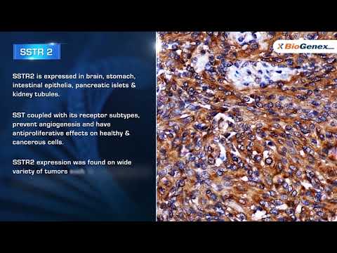 SSTR2 Antibody: Premium Quality Product by BioGenex