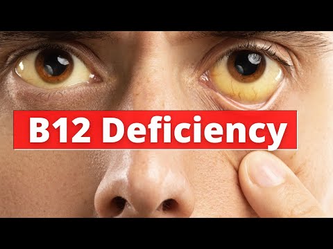 Causes, diagnosis, and treatment of vitamin B12 deficiency | Doctor explains