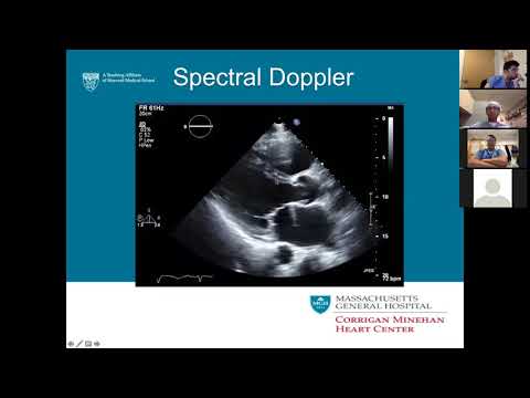 Cardiac Surgery Didactics—Basics of Echocardiography