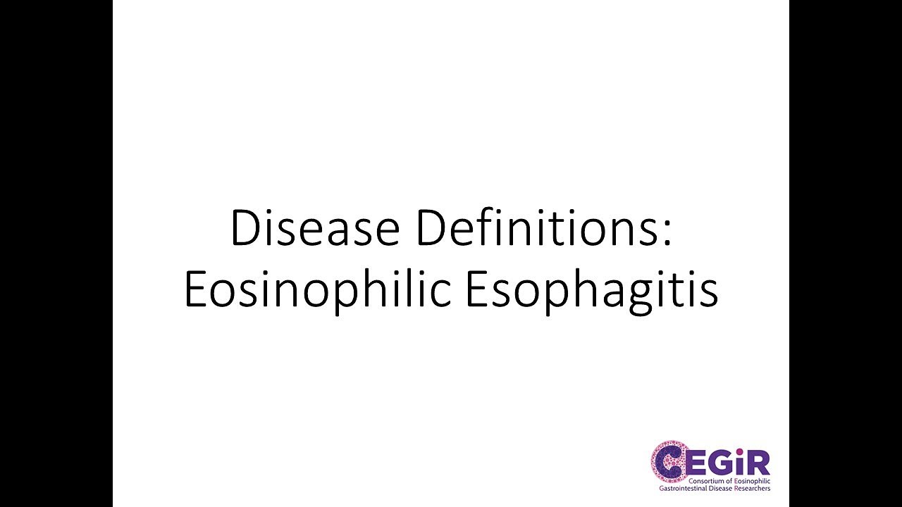 Eosinophilic Esophagitis (EoE): CEGIR Disease Definition