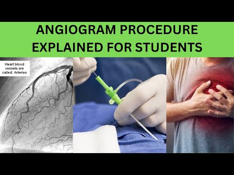 HOW IS ANGIOGRAM DONE EXPLAINED EASILY FOR STUDENTS.WHAT CARE TO BE TAKEN BEFORE AND AFTER ANGIOGRAM