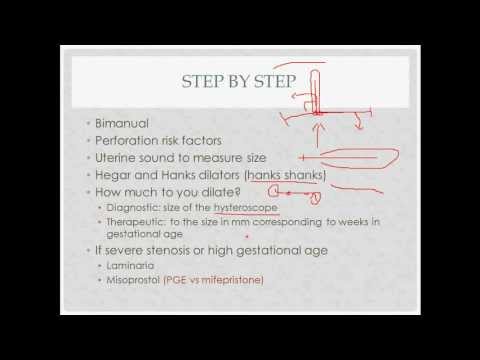 dilation and curettage - description, indications, and questions