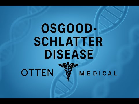 Osgood-Schlatter Disease and Adult Onset Pain at the Tibial Tuberosity