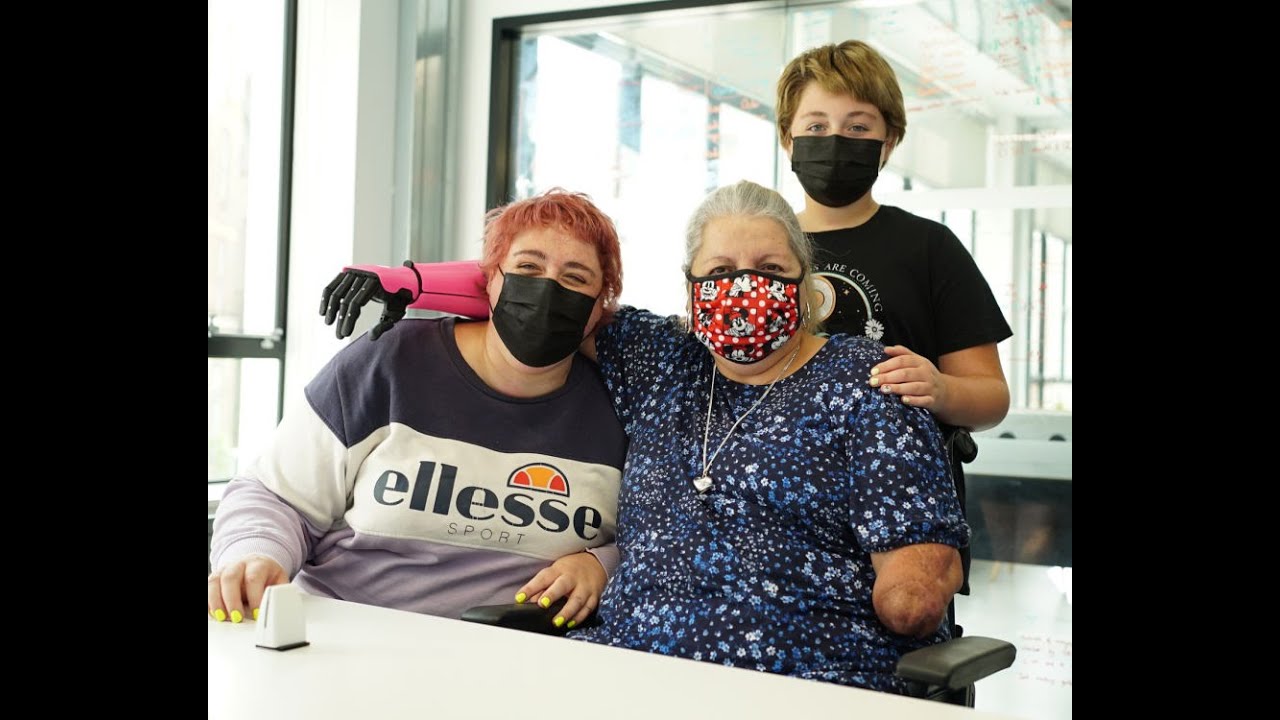 Mum Loses All Limbs to Sepsis - Gets Bionic Arm to Hug Family