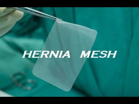 Hernia Mesh - Hernia Kit Latest Price, Manufacturers & Suppliers
