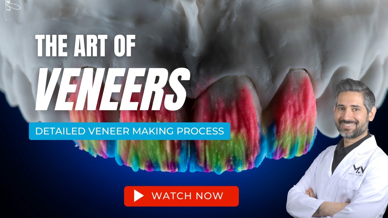Making Porcelain Veneers | The Art of Veneers