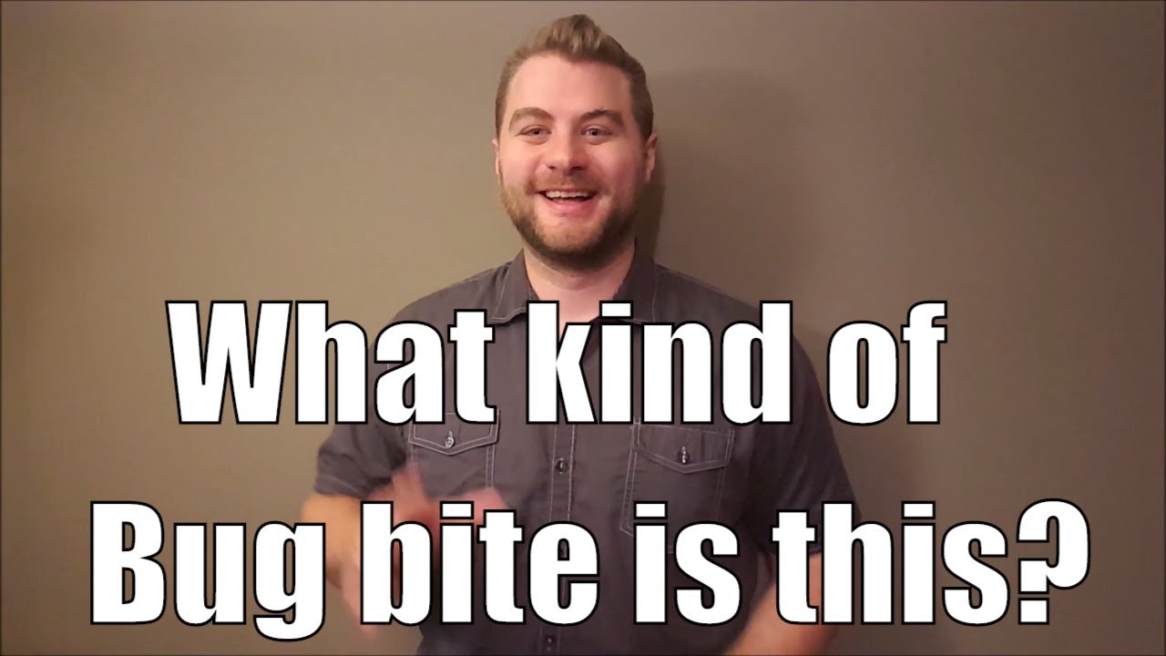 Are you able to tell me what kind of bug bite this is?