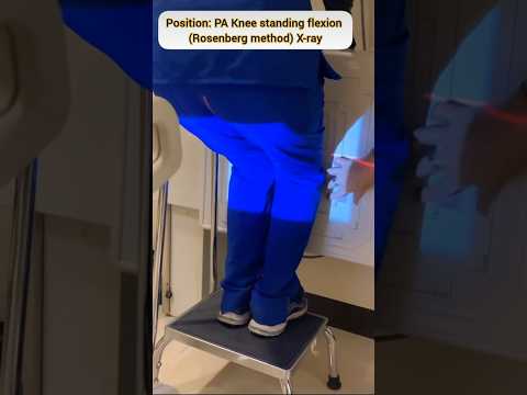 X ray knee standing flexion view #doctor #hospitaldoctor #mcstan #bestmedicalcollegeinindia