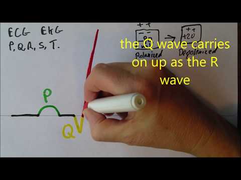 Heart 8, ECG waves