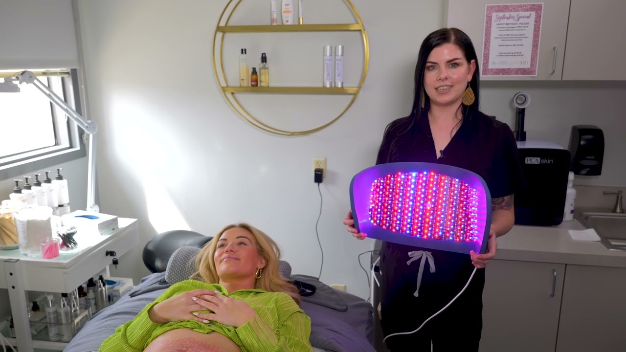 Morpheus8 and Celluma by Wilson MD Aesthetics in Scottsdale Arizona.
