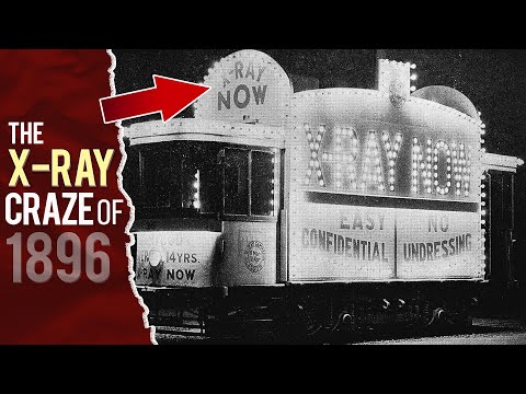 The X-Ray Craze of 1896