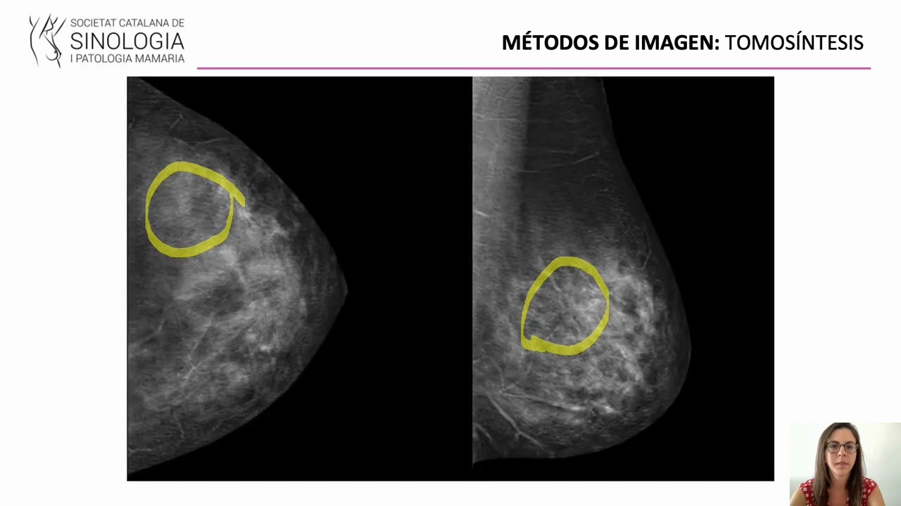 Módulo 3: Diagnóstico radiológico