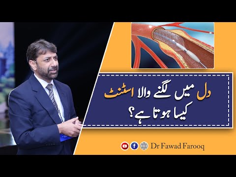 What is heart Stent how it looks like.Urdu/Hindi Dr.Fawad Farooq