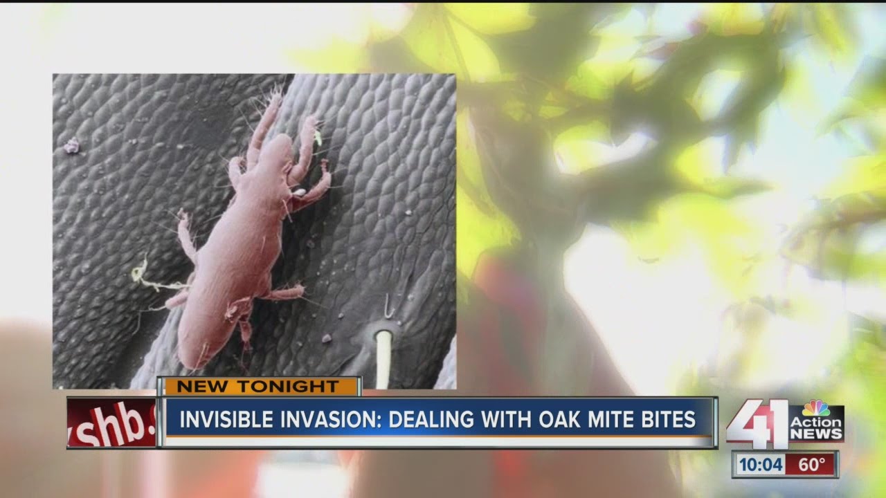 Kansas Citians suffering from Oak Mite bites