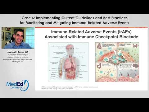 Case Review: Monitoring and Managing irAEs