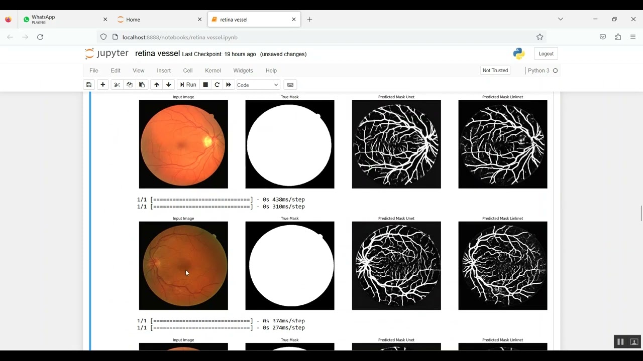 Multi Label Retinal Disease Classification Using Transformers - OKOK ...