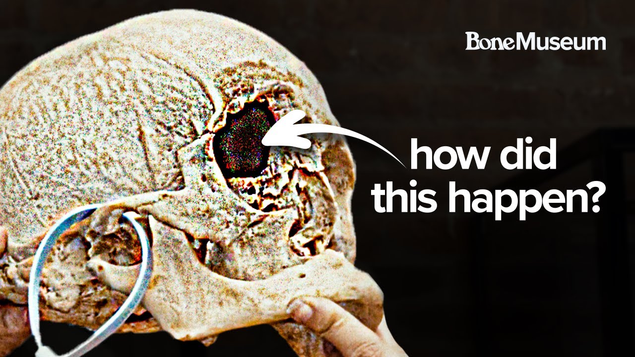 Bones Gone Wrong!? SHOCKING Pathologies in The Bone Museum