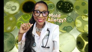 3 Best Allergists & Immunologists in Detroit, MI - Expert Recommendations