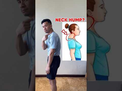 Learn how to fix NECK HUMP at home!! 🤩🤩🤩 #kyphosis #neckhump
