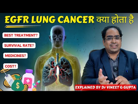 ईजीएफआर स्टेज 4 फेफड़ों कैंसर इलाज DM(AIIMS) - टागरिस्सो ओसिमर्टिनिब कैंसर की गोली, सर्वाइवल, कीमत