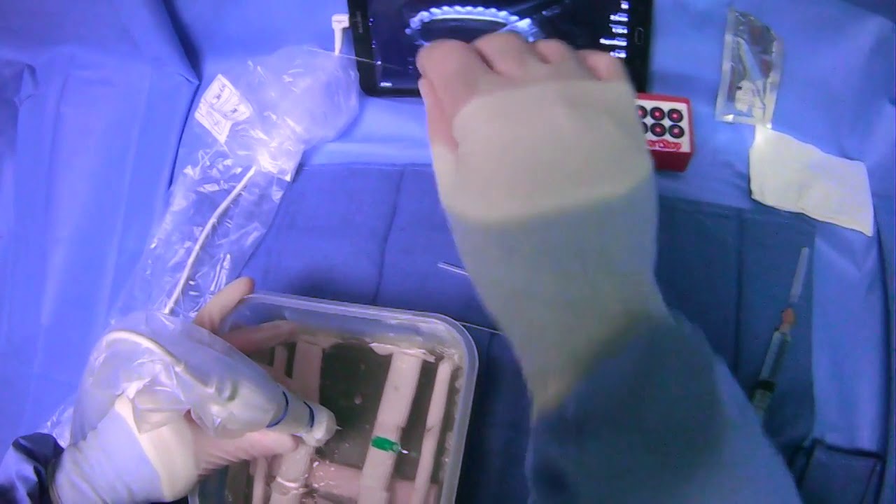 How To Use The Micropuncture Kit