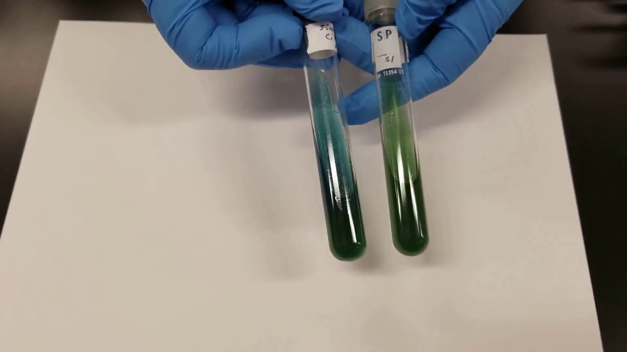 Simmon's Citrate Test
