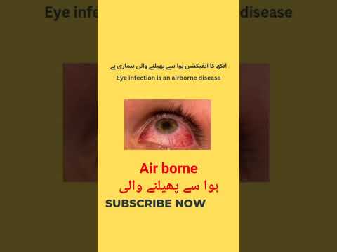 pink eye infection l urdu to english l urdu to english sentences l daily short sentences