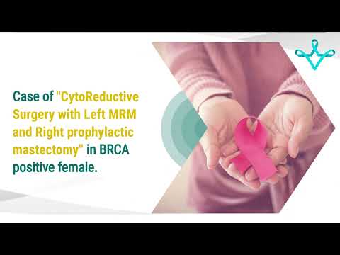 Case of CytoReductive Surgery with Left MRM and Right prophylactic mastectomy | Airavat Cancer Care