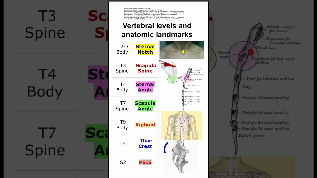 Vertebral levels and anatomic landmarks