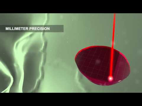 pencil beam scanning IBA Proton Therapy