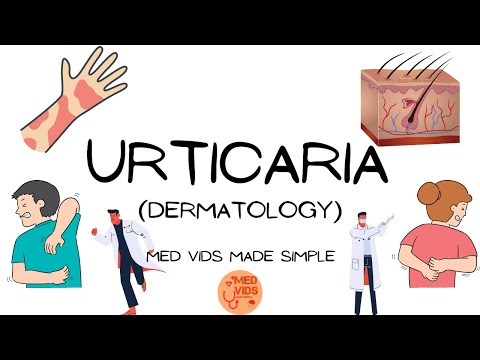 Urticaria | Dermatology (Pathophysiology,clinical features,diagnosis,treatment) MedVidsMadeSimple