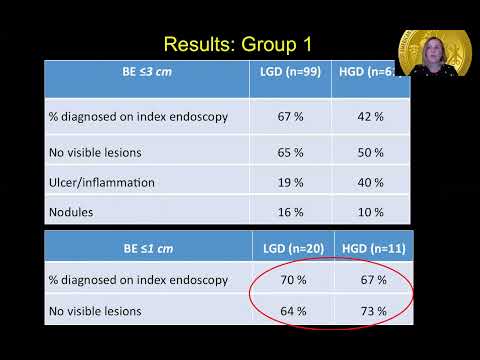LENGTH OF BARRETT'S ESOPHAGUS IN THE PRESENCE OF LOW GRADE DYSPLASIA, HIGH GRADE DYSPLASIA AND A...