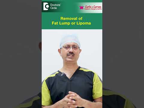 Removal of Fat Lump on Body | Lipoma treatment | Small Lipoma | Large Lipoma #lipoma- Dr.Girish A C