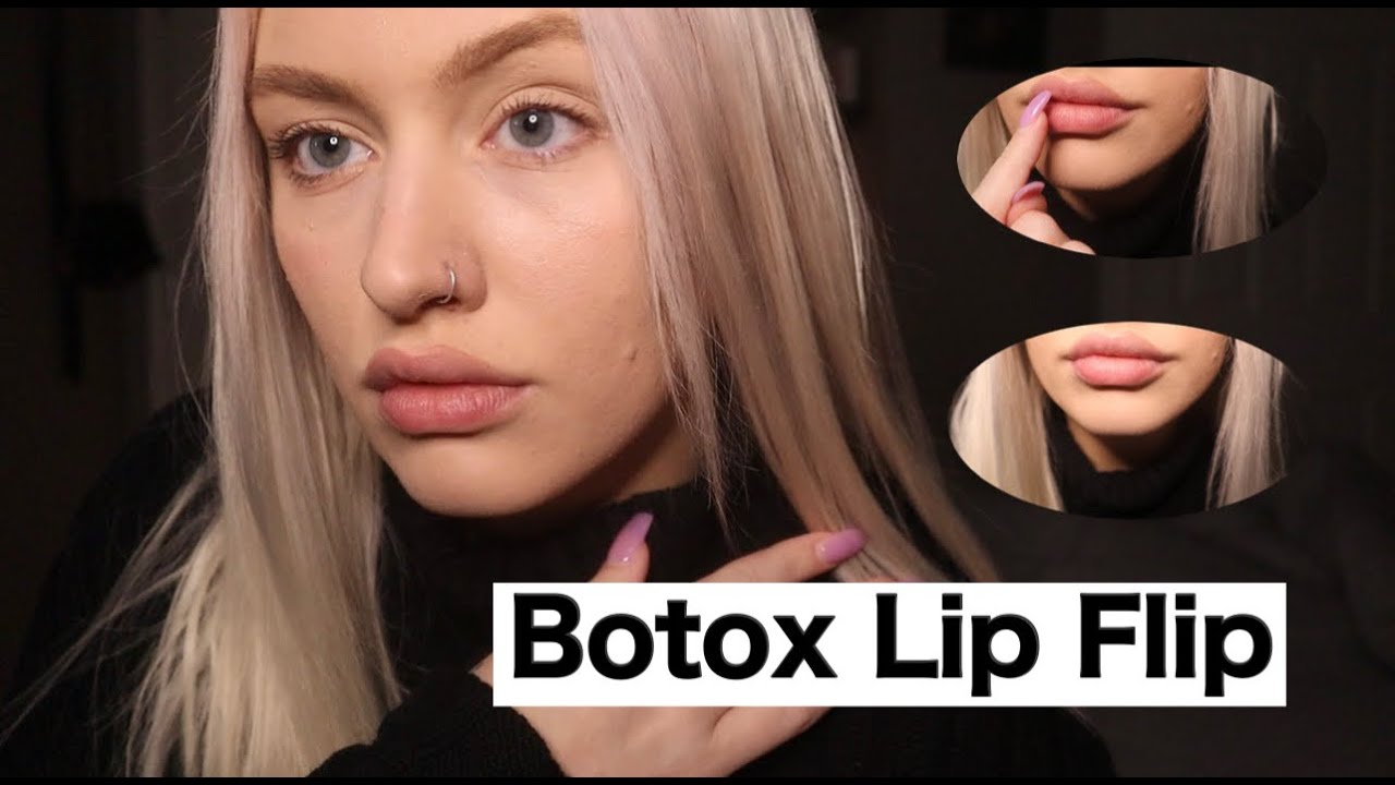 I GOT A LIP FLIP!! WAS IT WORTH IT??