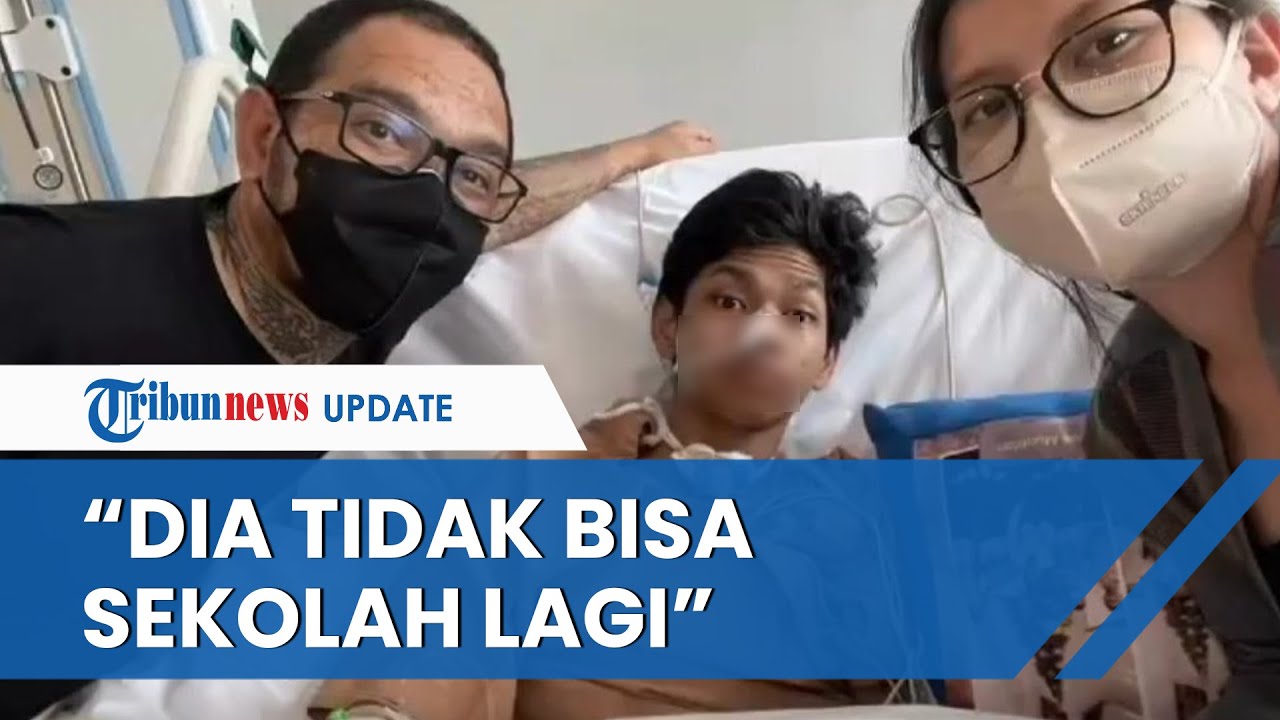 Derita David, Alami Trauma Keras hingga Semua Saraf Putus, Jonathan ... Derita David, Alami Trauma Keras hingga Semua Saraf Putus, Jonathan ...