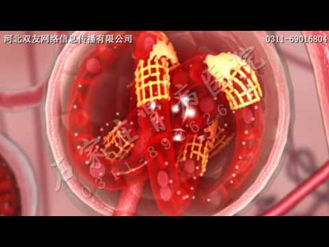 Kidney Disease Treatment-IgA Nephropathy