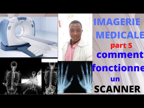 IMAGERIE MÉDICALE part5: Comment fonctionne un scanner/ How a scanner works